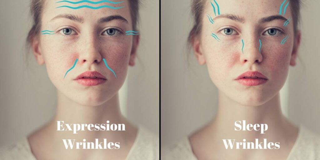 How to Get Rid of Sleep Wrinkles • 5 Ways